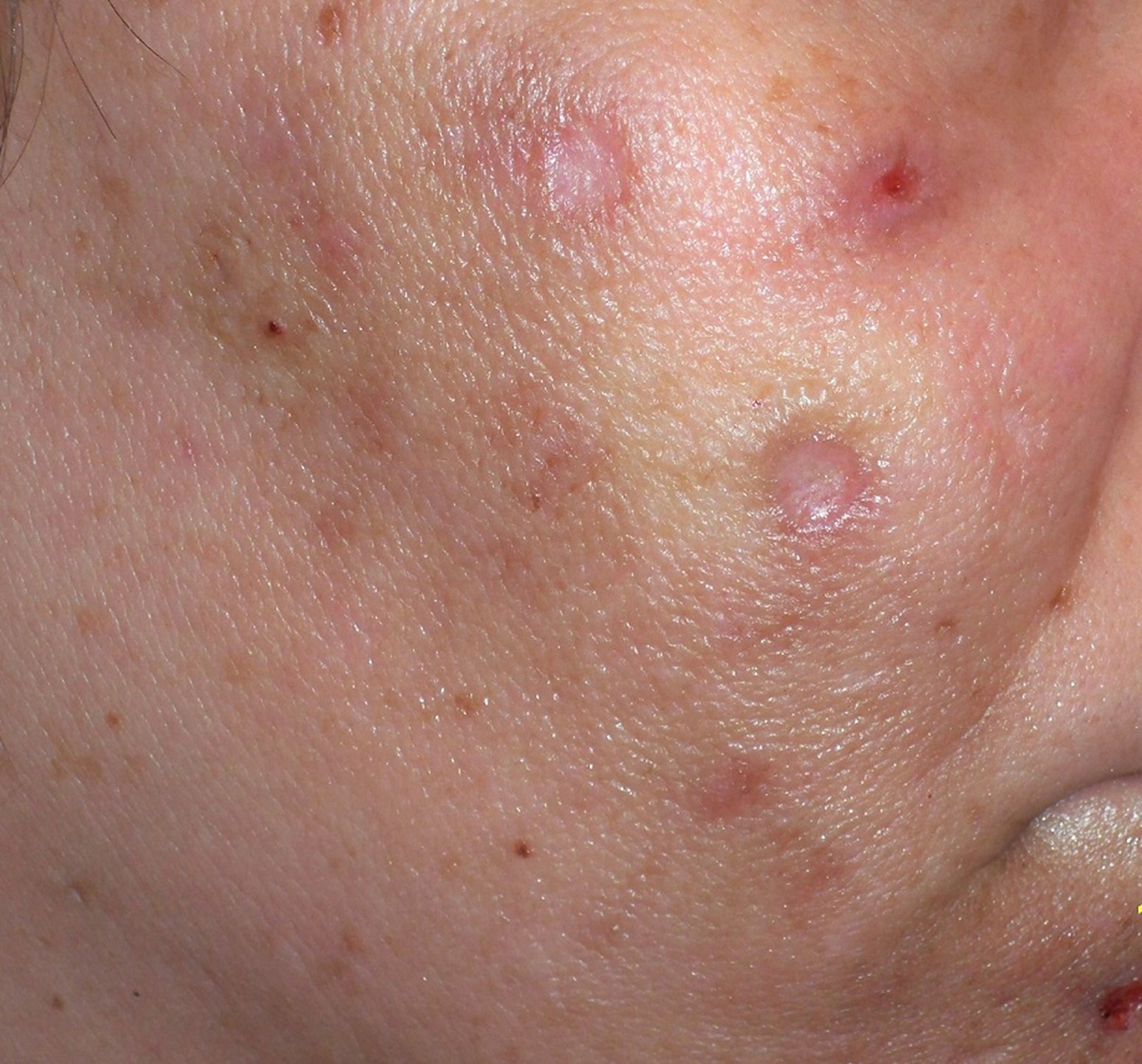 Story of Barbara - Gratia Botanica