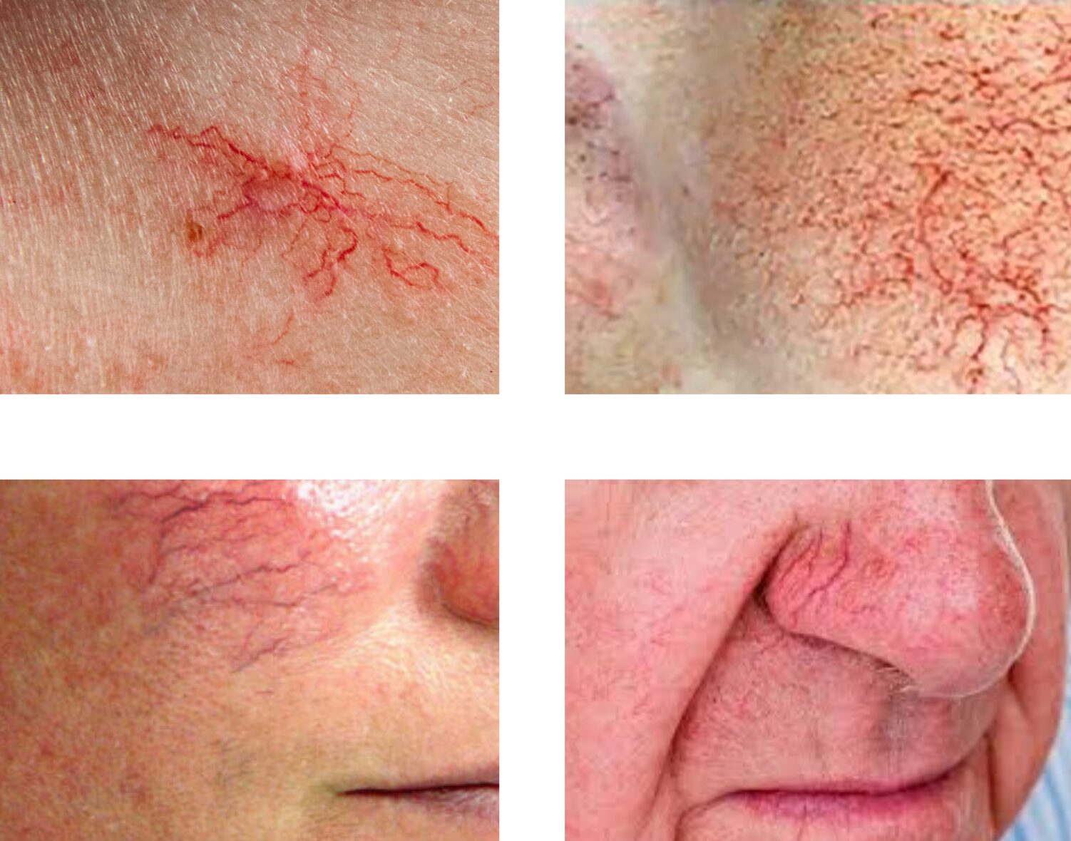 ThermoClear Information - Gratia Botanica
